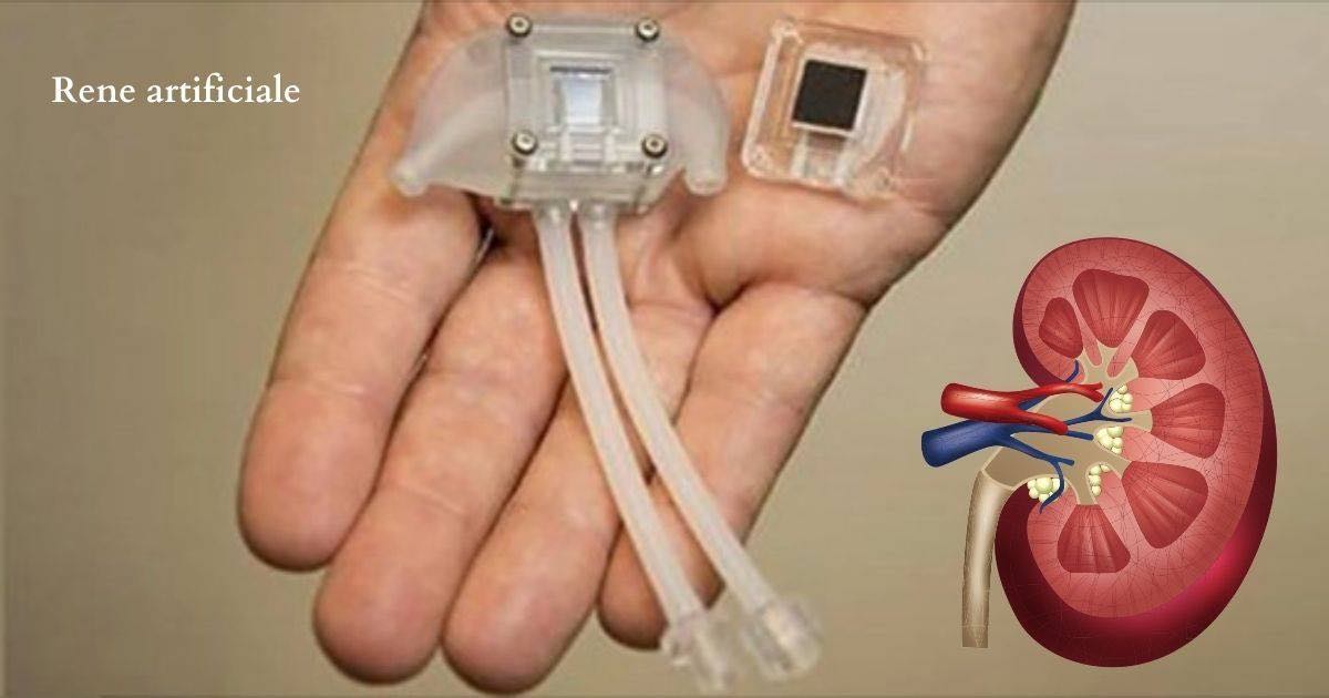Il rene bionico, l'organo artificiale che permetterà di dire addio all ...