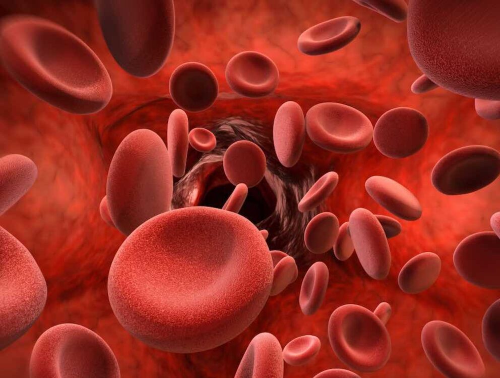 Piastrinopenia autoimmune: cause, sintomi, diagnosi e cure
