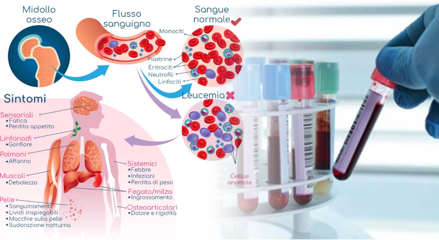Scoperto un nuovo gruppo sanguigno: come si chiama e perché è ...